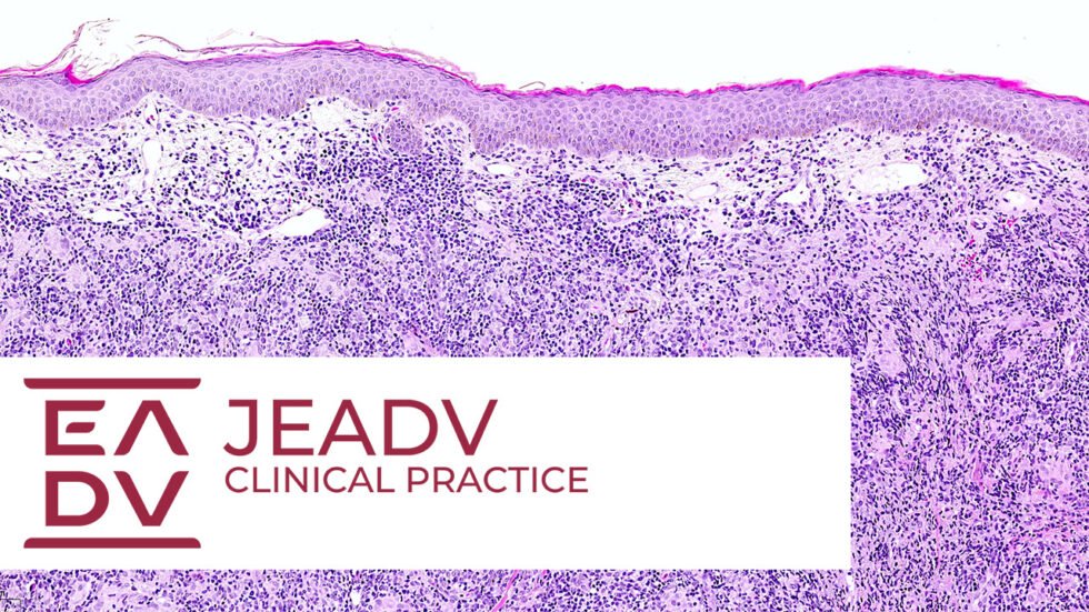 Membership Benefits | EADV