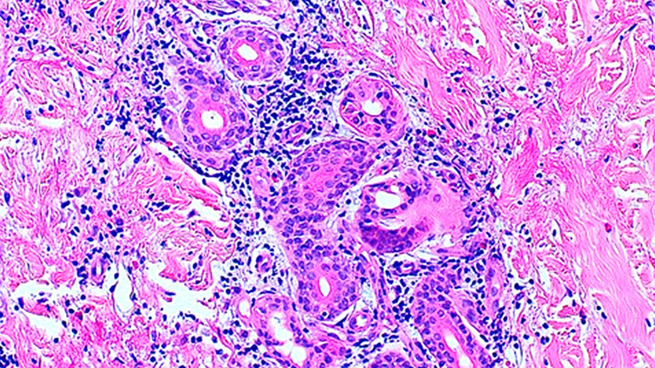 EADV | European Academy of Dermatology and Venereology