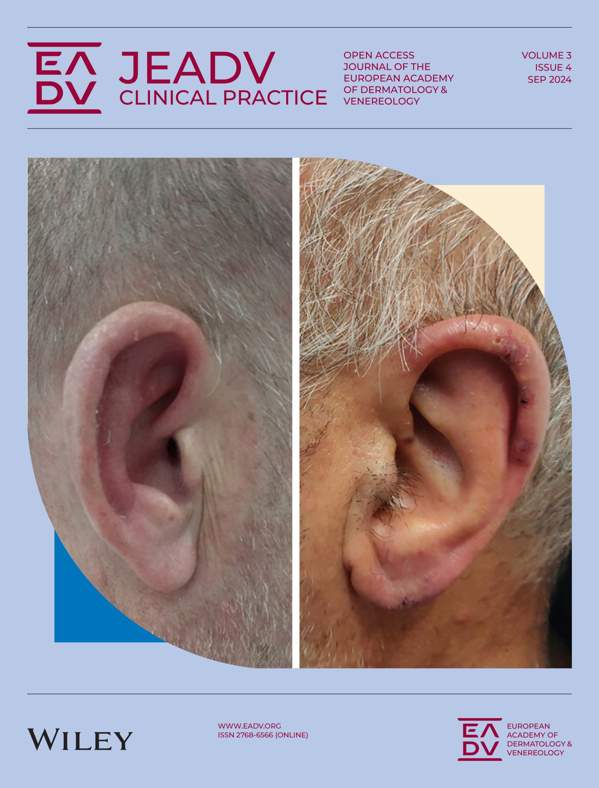 JEADV Clinical Practice | Open-access Dermatology Journal