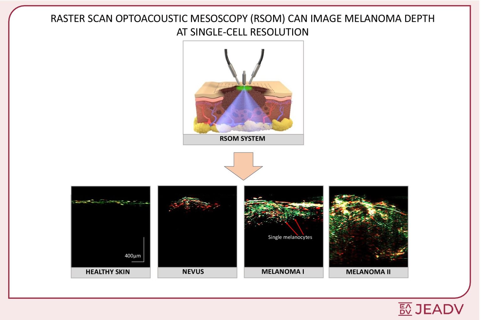 Journal of the European Academy of Dermatology & Venereology